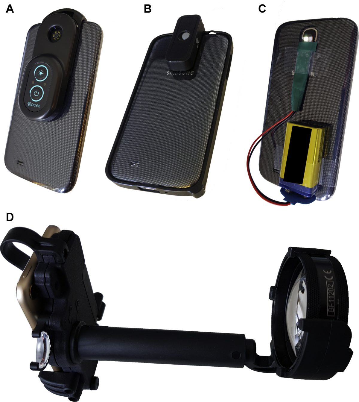 Diabetic Retinopathy - Causes, Symptoms, Treatment | Low Vision Aids