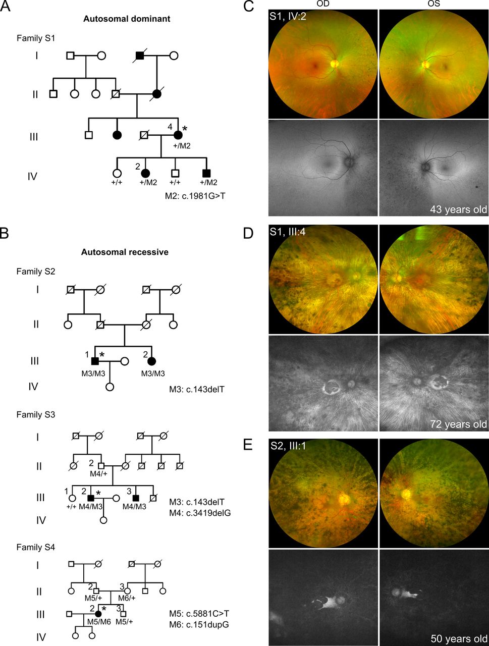 Retinitis Pigmentosa - Symptoms, Causes, & Treatment | Low Vision Aids