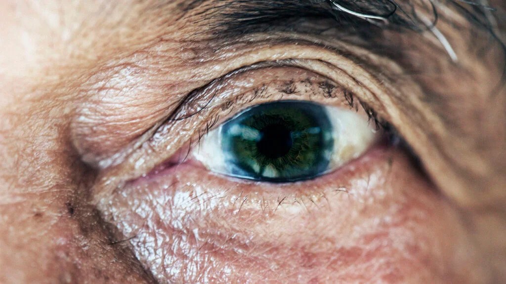 What You Should Know About NHS Macular Degeneration Treatment - Low Vision Aids