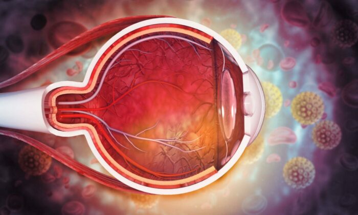 Understanding Large Optic Nerve Without Glaucoma | Blog